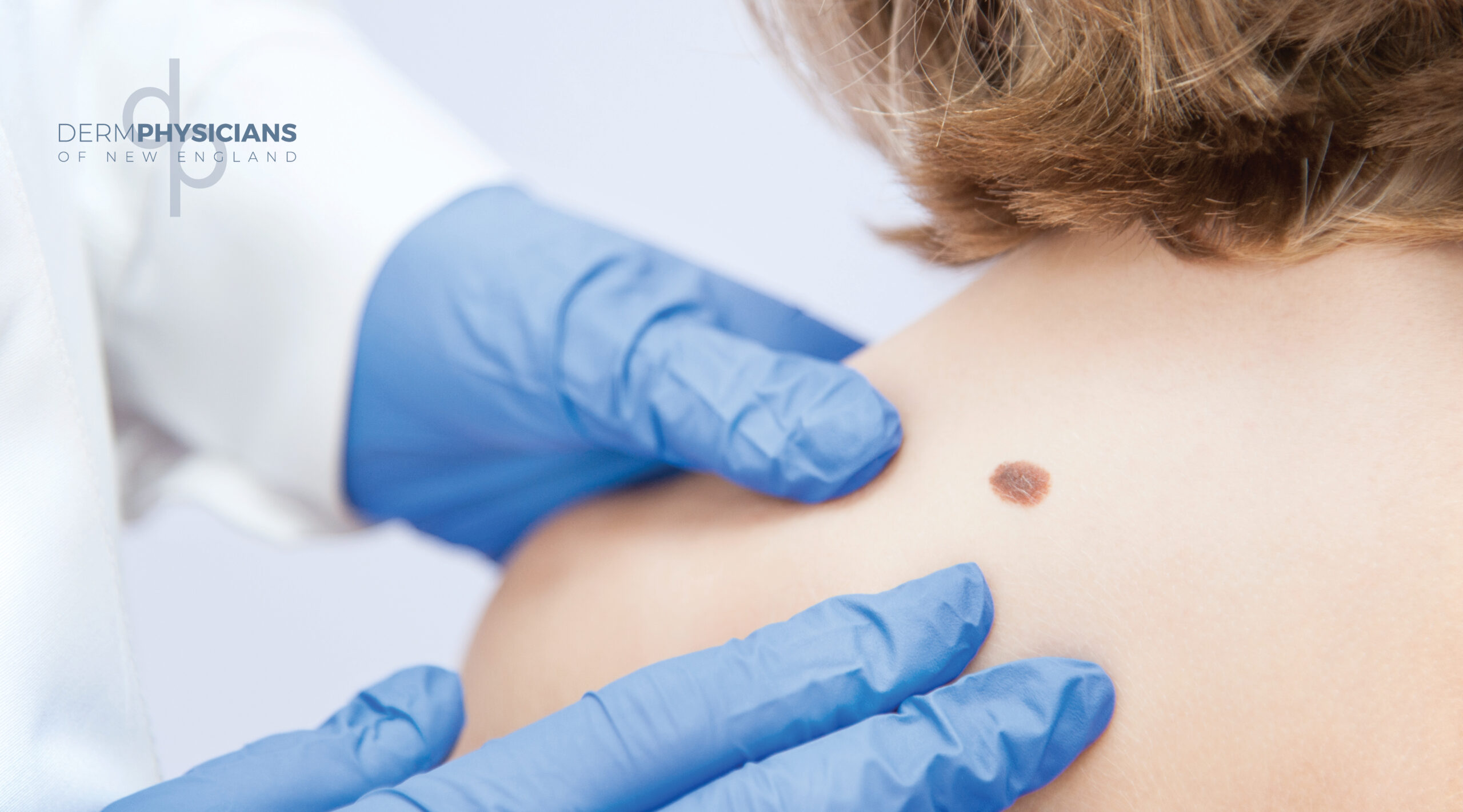 Melanoma In 2025 What You Still Need To Know Dermphysicians Of New